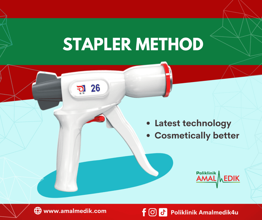 Circumcision For Male/Adult - The Best Technique - Poliklinik Amalmedik